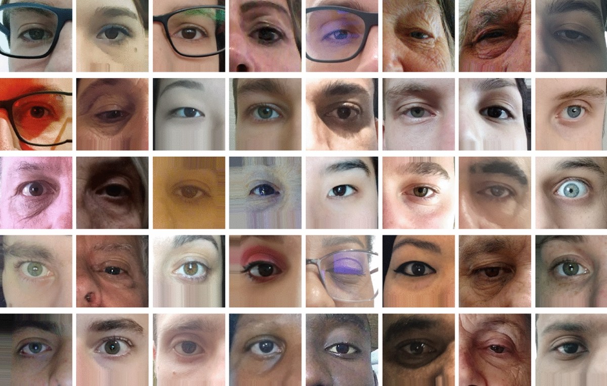 Diseases of the Eye – Sam Schneider Optometry Johannesburg